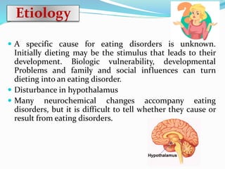 Eating disorders ( Anorexia nervosa and Bulimia nervosa) | PDF