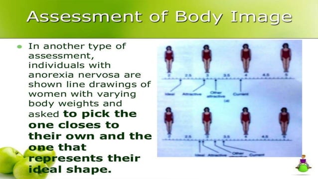 Eating disorders | PPT
