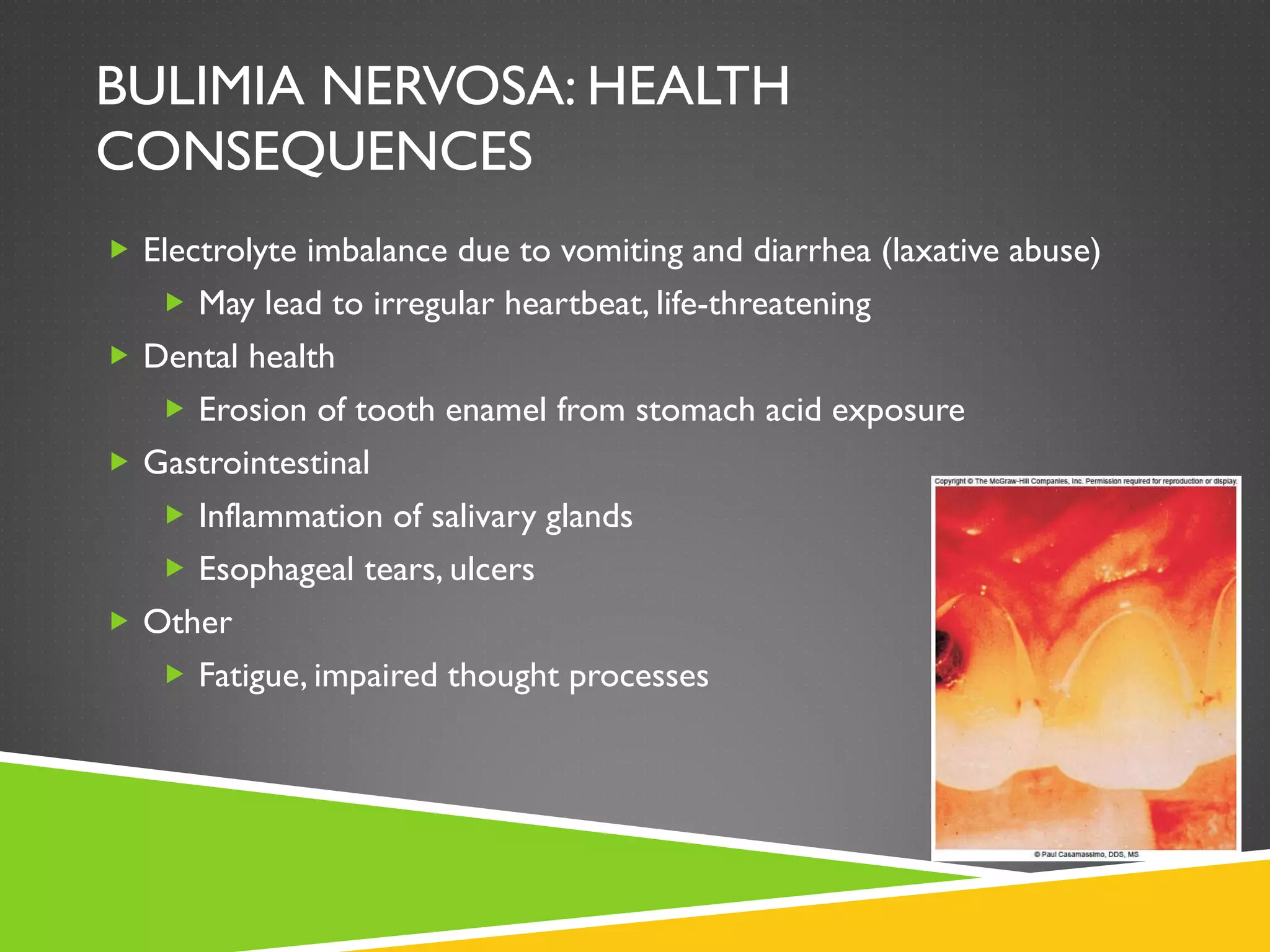 Eating disorders ch13 | PPT