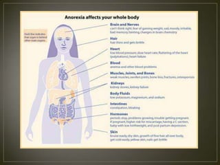 Common Eating Disorders Presentation | PPT