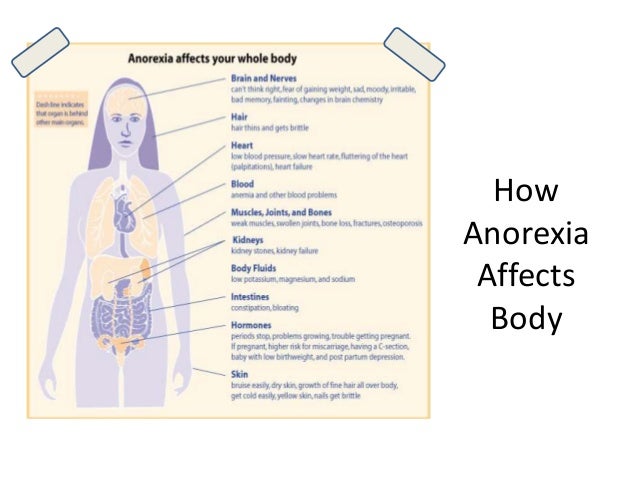 Anorexia And Bulimia Affect Your Body
