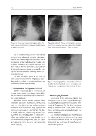 EB03-04_radiologia_general.pdf | Lung and Respiratory Health | Diseases ...