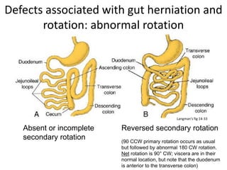Eb4 gut development | PPT