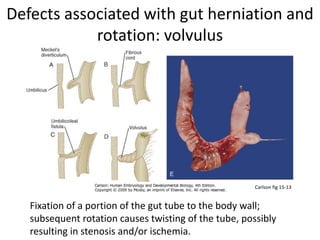Eb4 gut development | PPT