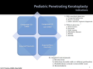 Pediatric Penetrating Keratoplasty | PPT