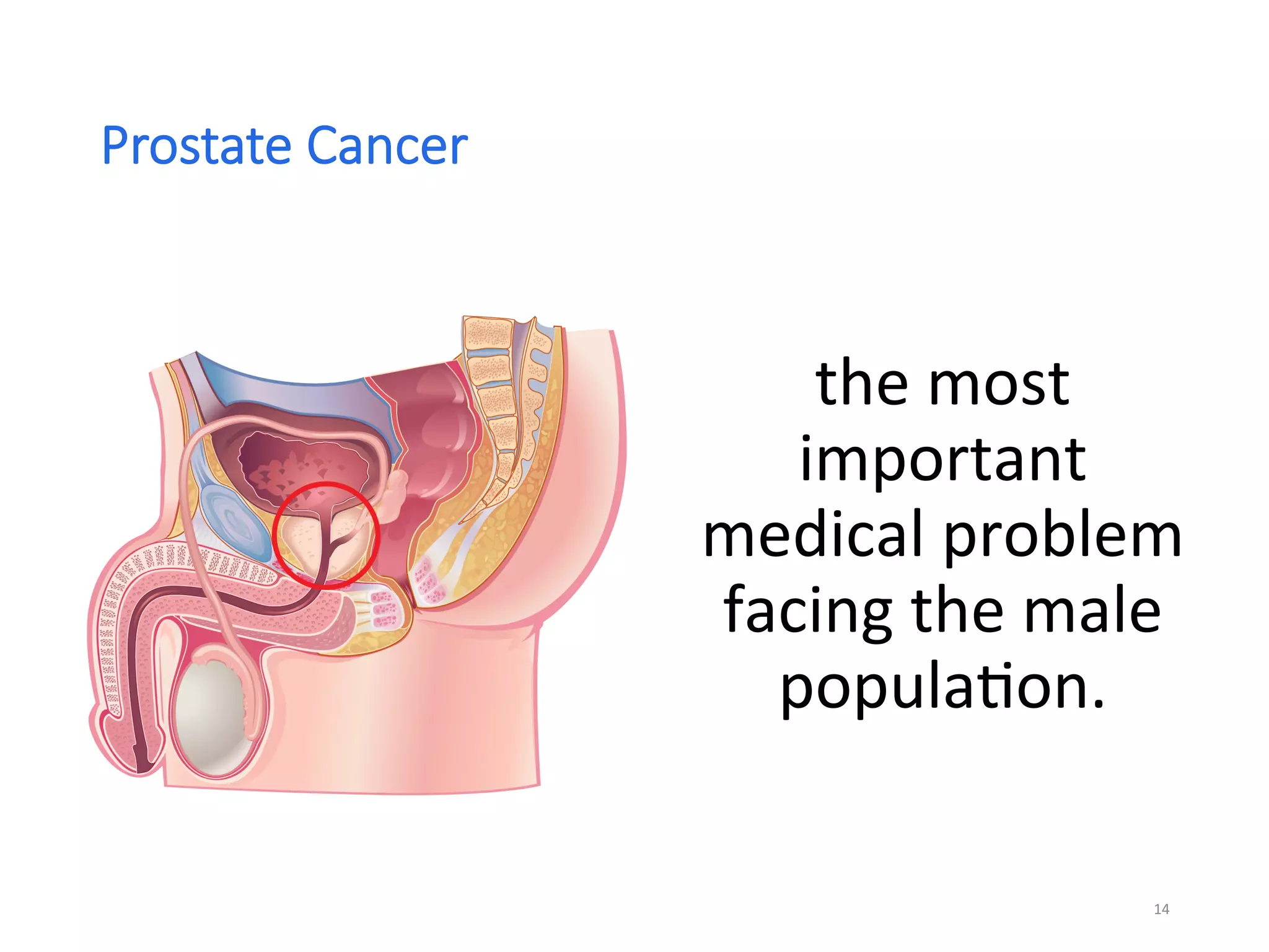 Penile Rehabilitation After Prostate Cancer Treatment Is There An
