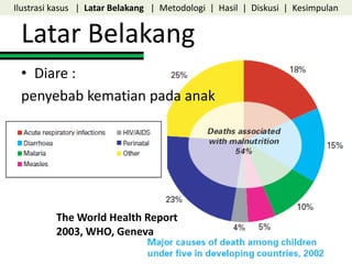 Ebcr ikhsan-pediatric-slide show | PDF