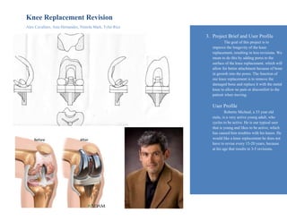 Knee Replacement Revision | PDF