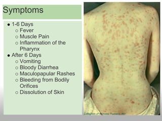 Maculopapular Rash Ebola