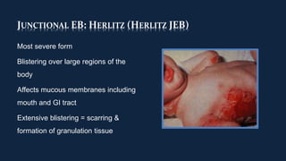 Eb presentation final | PPTX