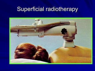 EBRT and brachytherapy radiology go3.ppt