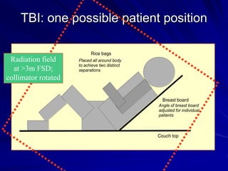 EBRT and brachytherapy radiology go3.ppt