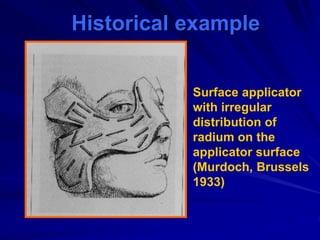 EBRT and brachytherapy radiology go3.ppt