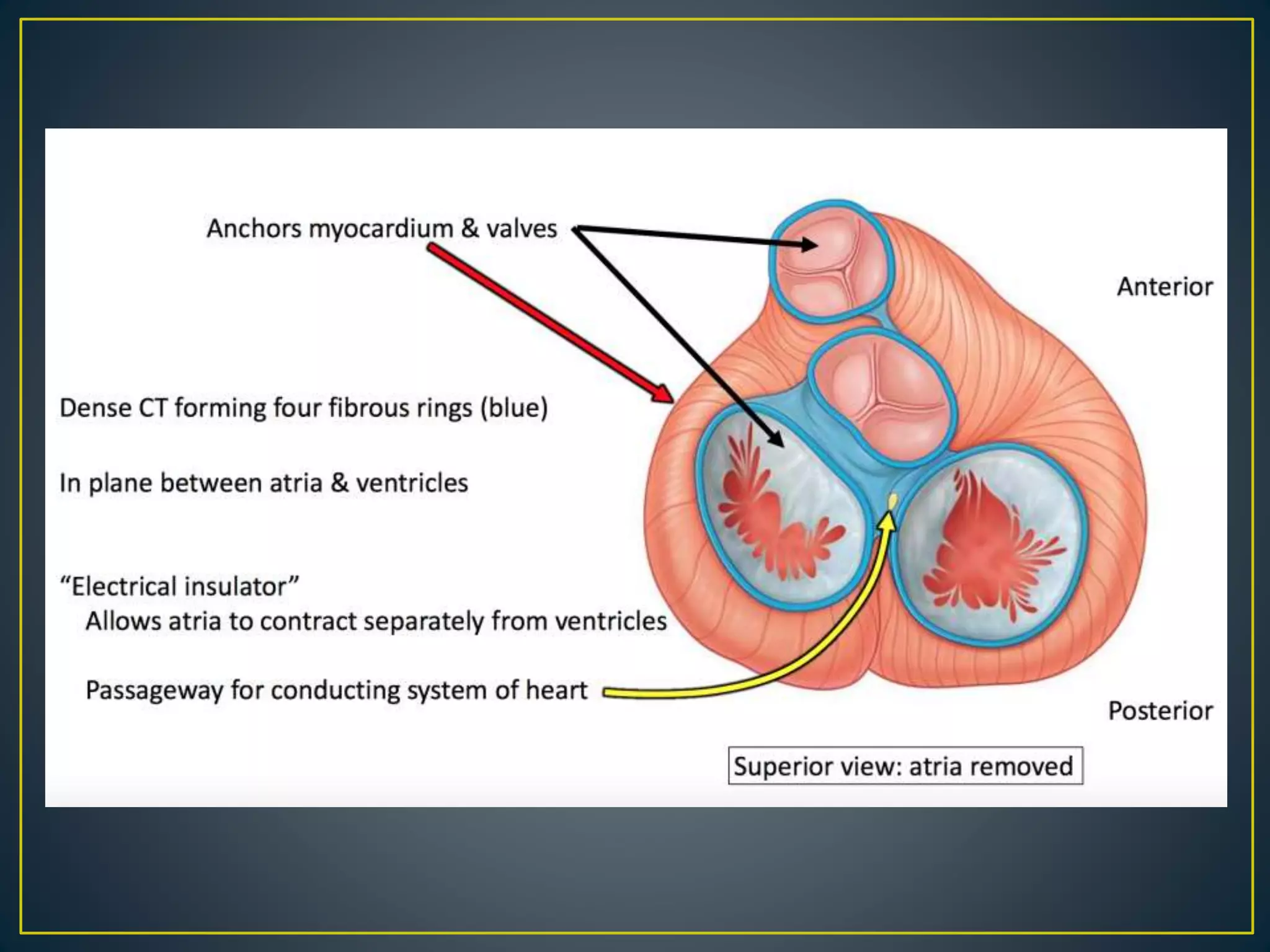 Ebstein Anomaly | PPTX