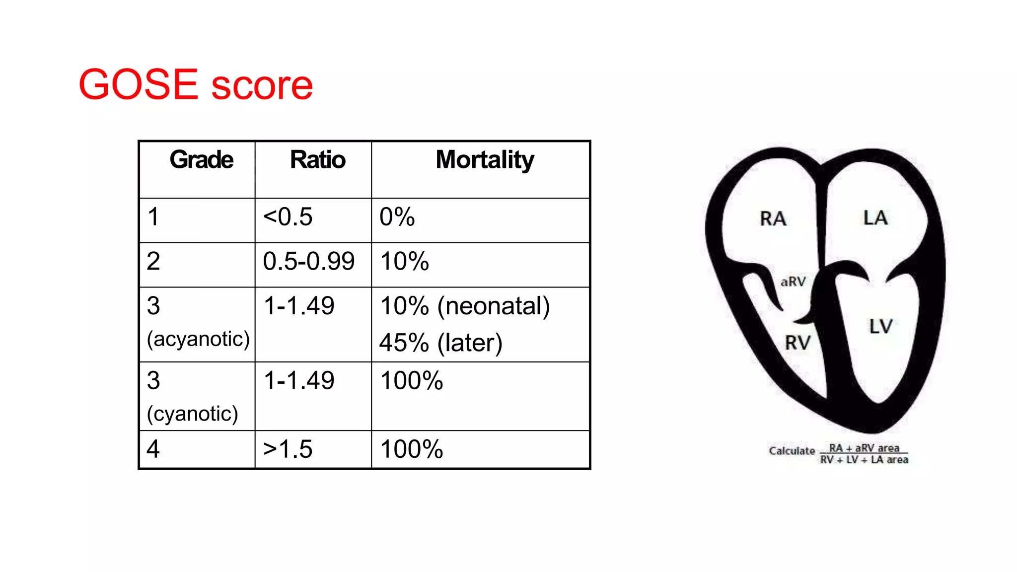 Ebstein anomaly | PPTX