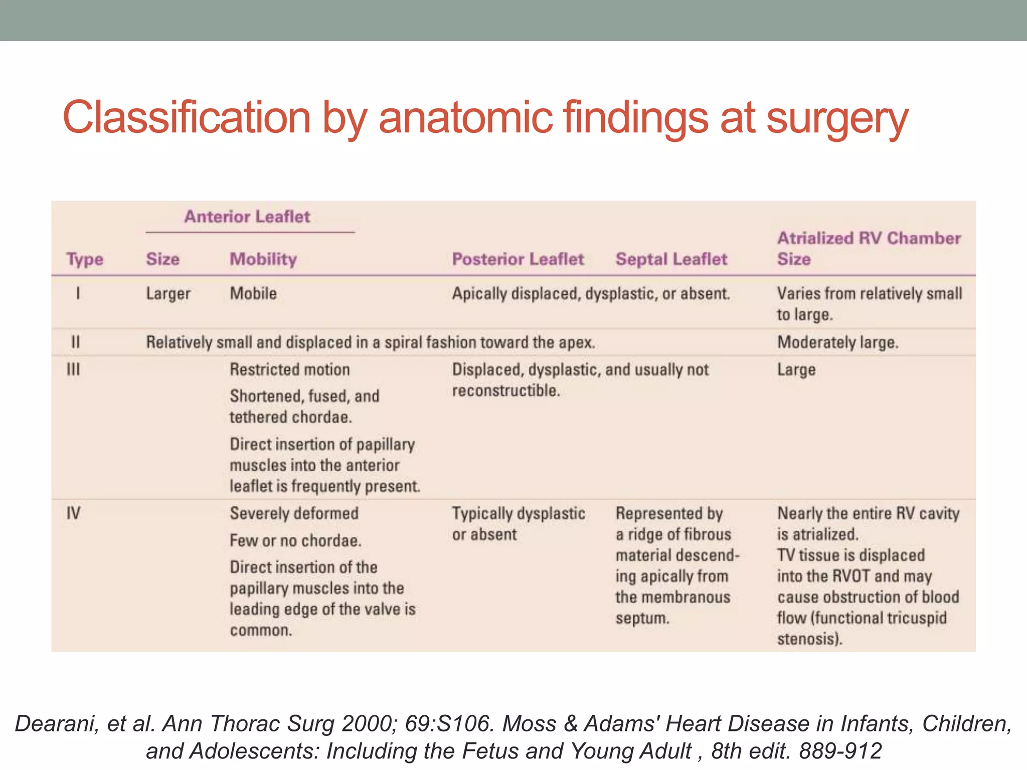 Ebstein anomaly | PPTX
