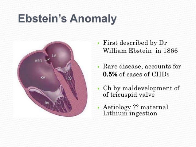 Ebstein’s anomaly & Truncus Arteriosus