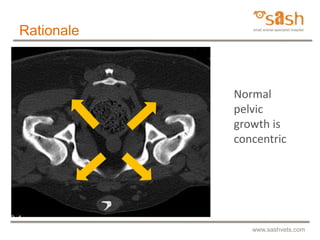 SASH : Juvenile pubic symphysiodesis by Dr Daniel R James | PPT