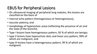 Endobronchial ultrasound - EBUS | PPTX
