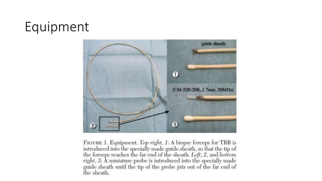 Endobronchial ultrasound - EBUS | PPTX | Lung and Respiratory Health ...