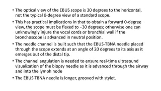 Endobronchial ultrasound - EBUS | PPTX