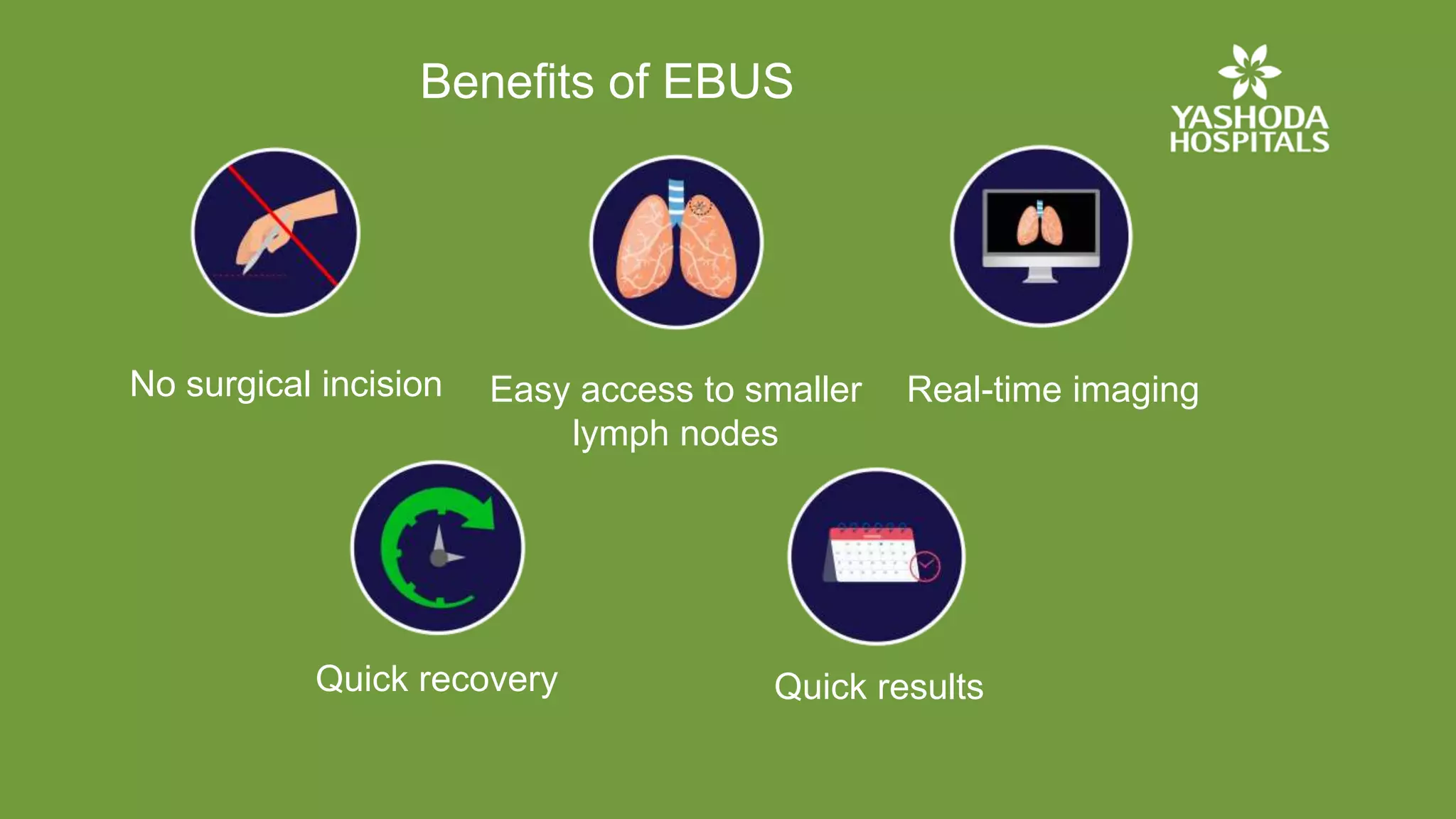 Endobronchial Ultrasound Bronchoscopy (EBUS) | PPTX