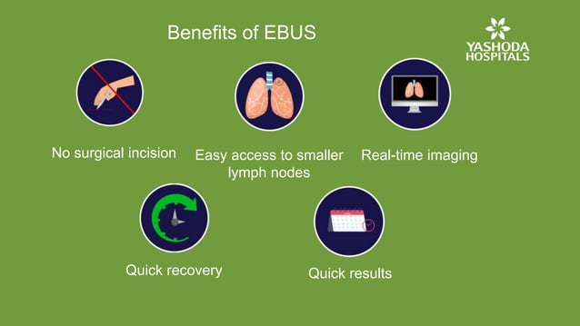 Endobronchial Ultrasound Bronchoscopy (EBUS) | PPTX | Lung and Respiratory Health | Diseases and ...
