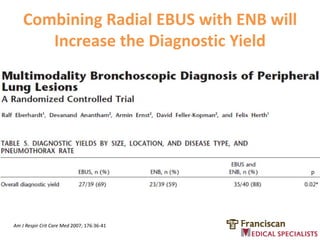 Endobronchial Ultrasound Guidance of TBNA. Current Approach To Lung Cancer Staging: How EBUS ...