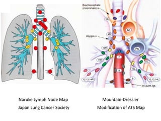 Endobronchial Ultrasound Guidance of TBNA. Current Approach To Lung Cancer Staging: How EBUS ...