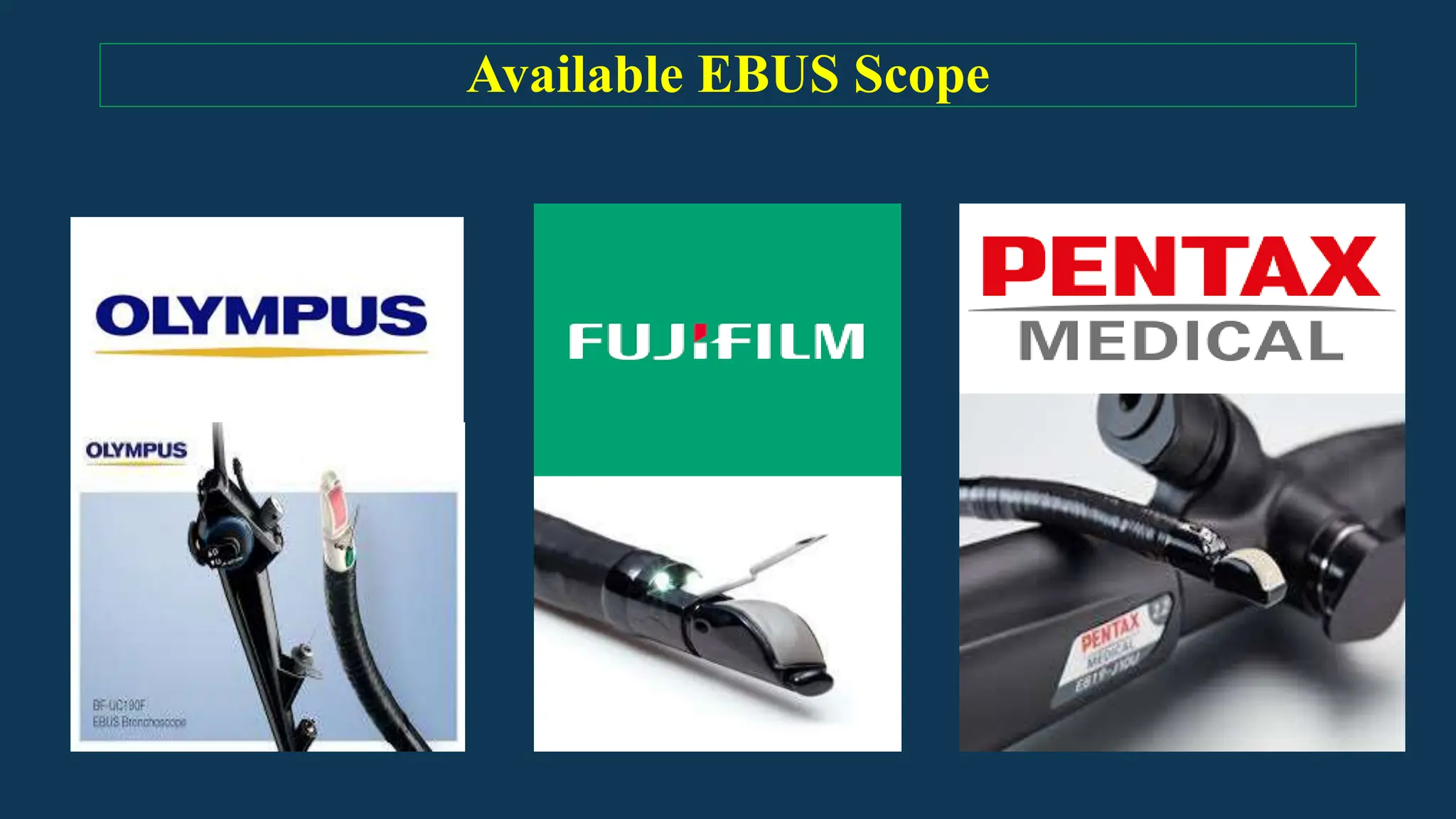 ENDO BRONCHEAL ULTRASONOGRAPHY (EBUS)_Chandan.pdf