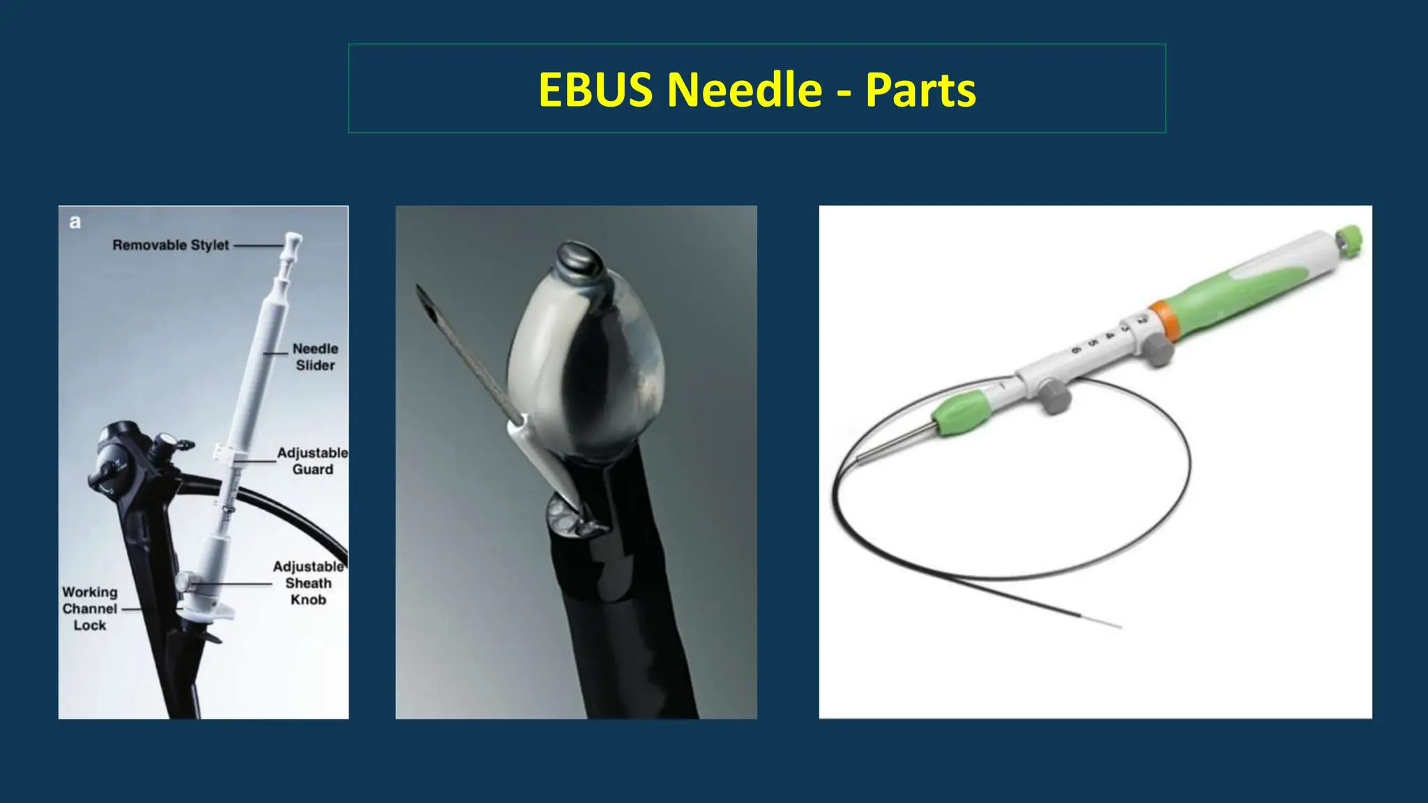 ENDO BRONCHEAL ULTRASONOGRAPHY (EBUS)_Chandan.pdf