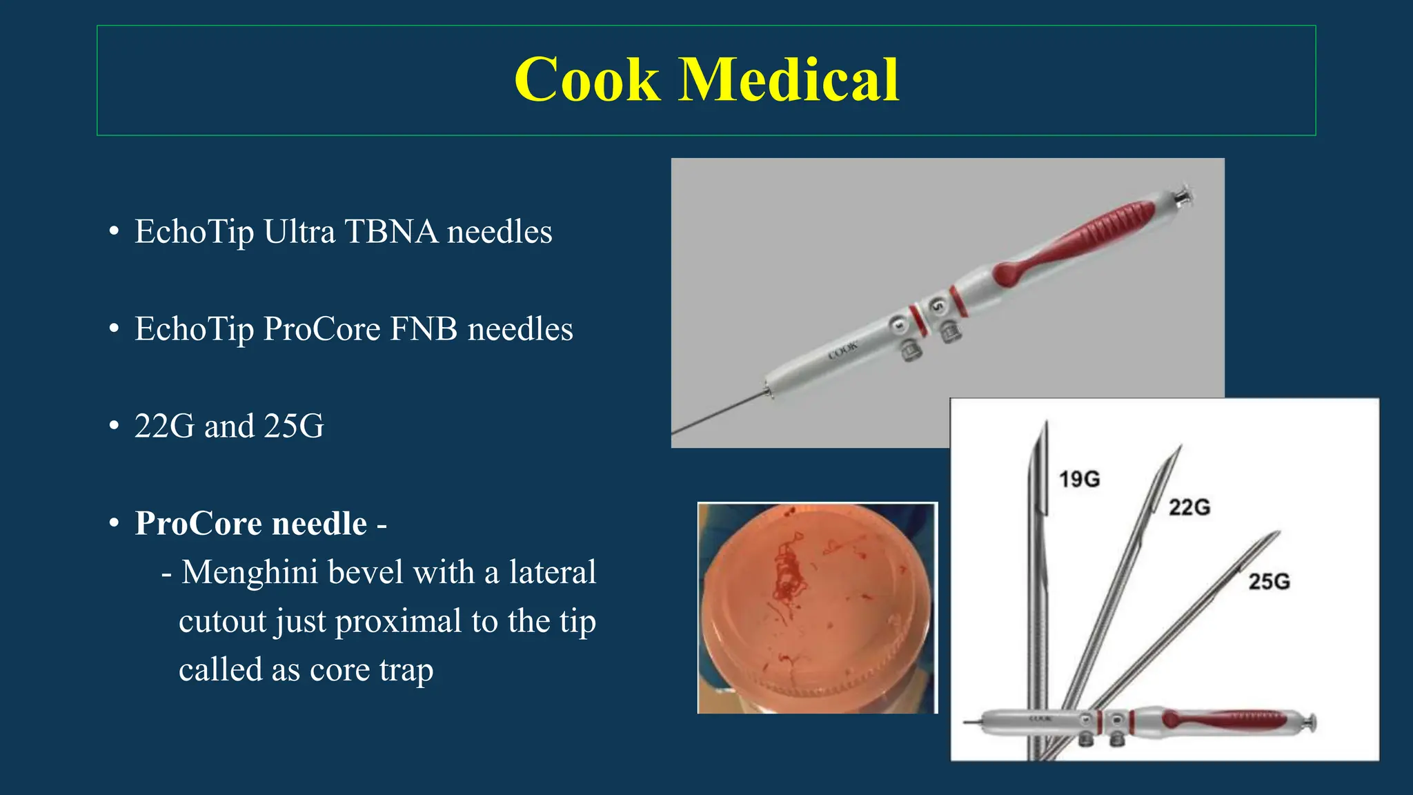 ENDO BRONCHEAL ULTRASONOGRAPHY (EBUS)_Chandan.pdf