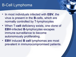 epstein-bar virus (EBV) | PPT