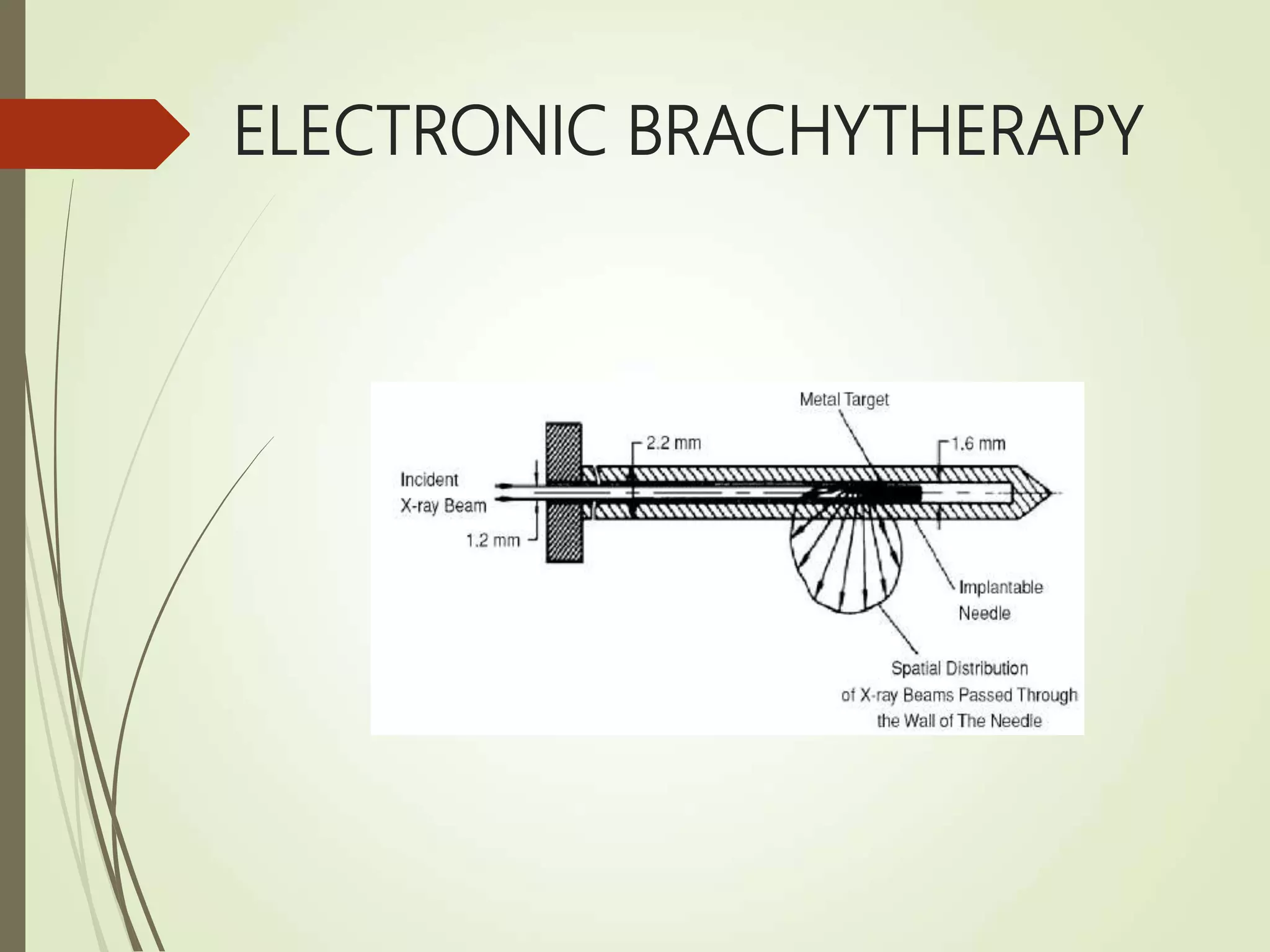Electronic Brachytherapy | PPT