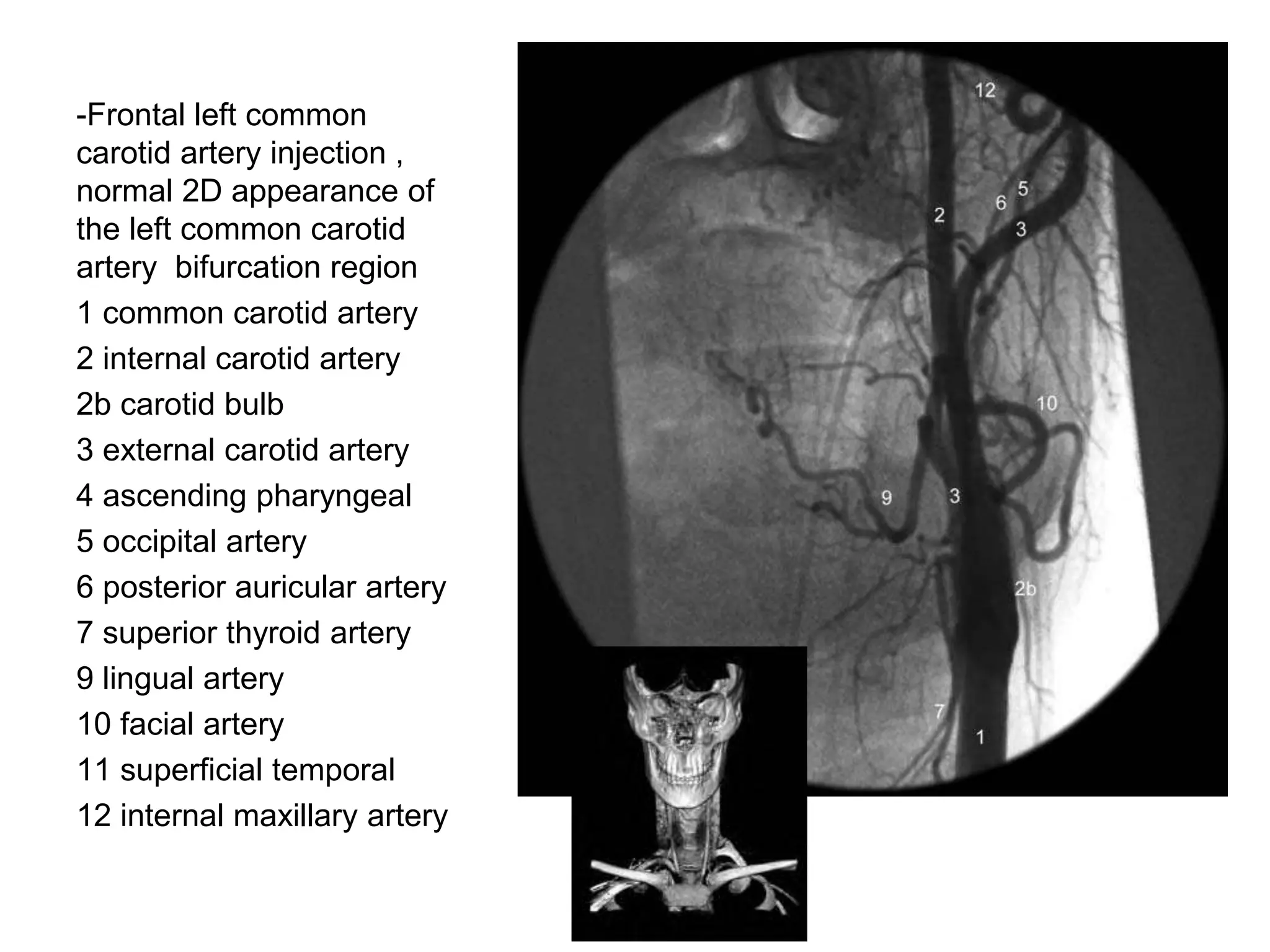 Anatomy of the external carotid artery (ECA) | PPT