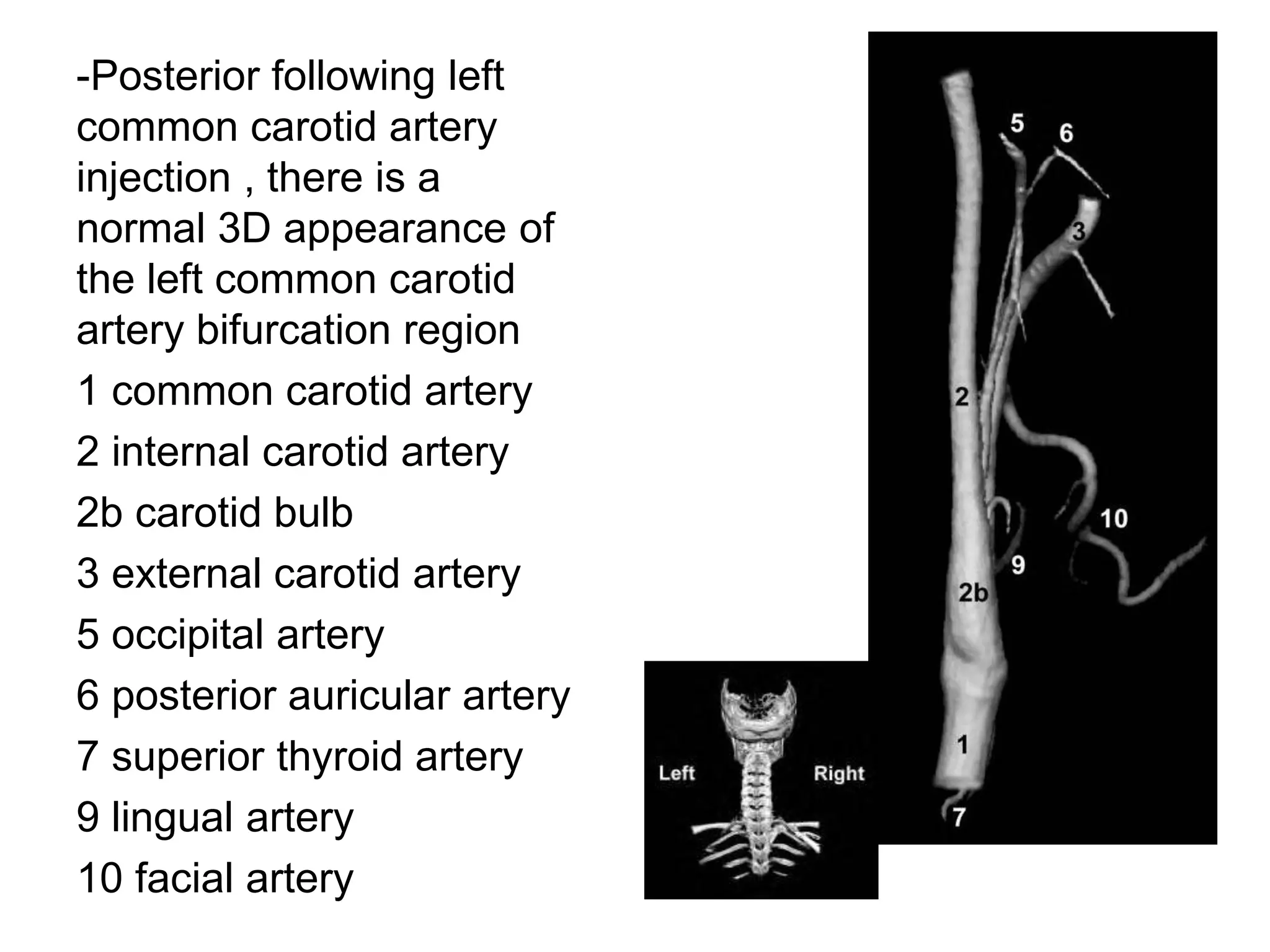Anatomy of the external carotid artery (ECA) | PPT