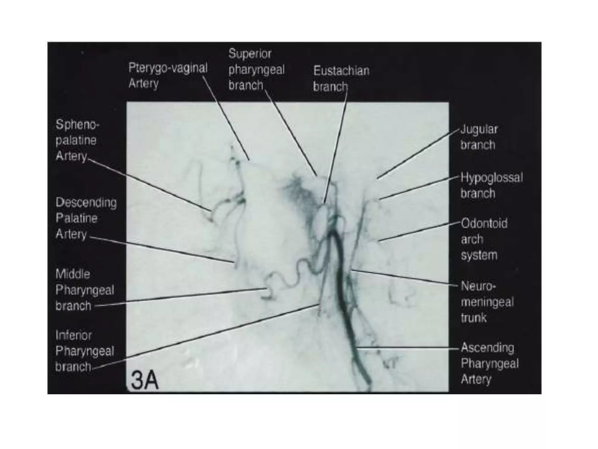 Anatomy of the external carotid artery (ECA) | PPT | Death, Injury, or Military Conflict ...