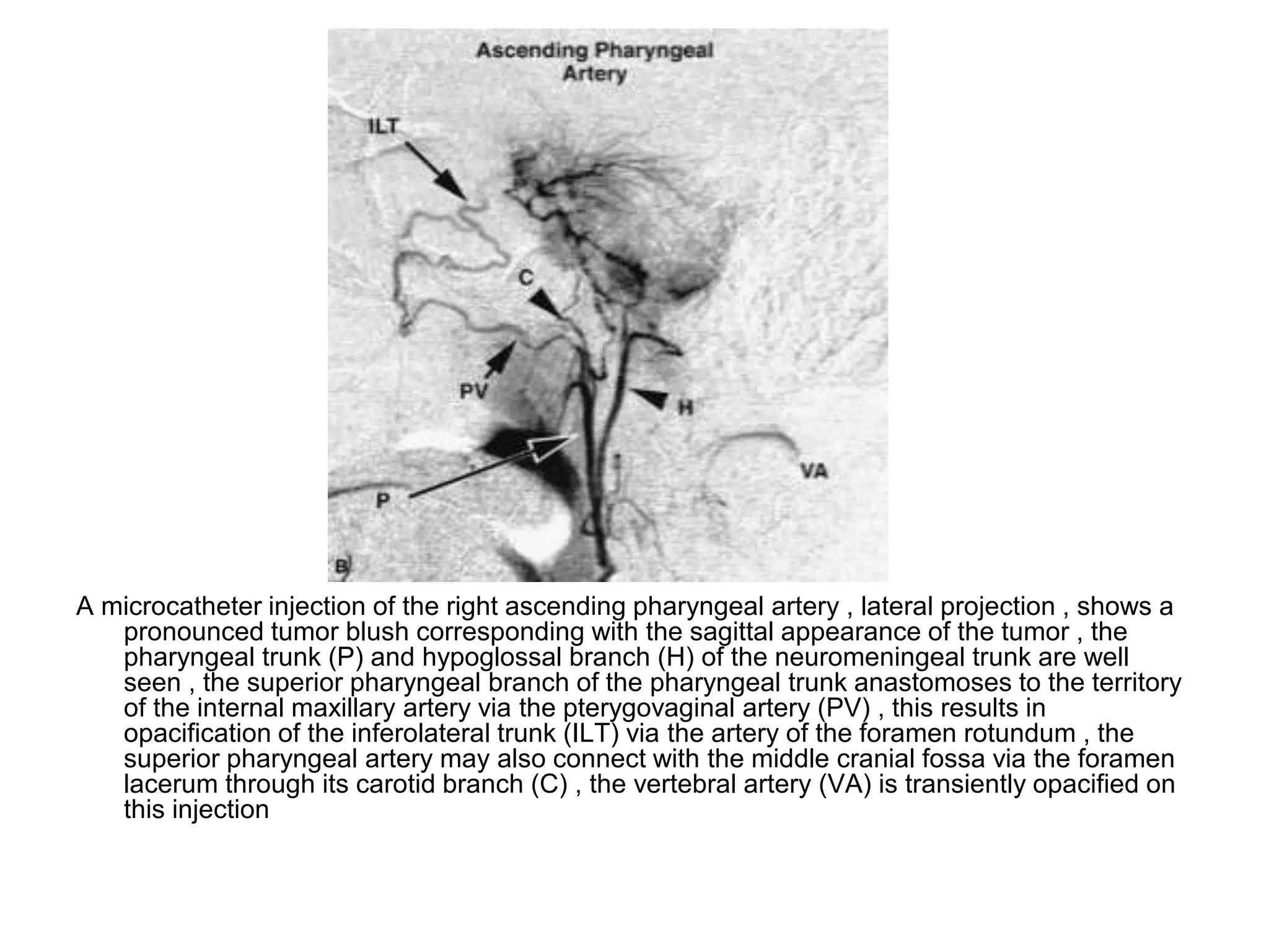 Anatomy of the external carotid artery (ECA) | PPT