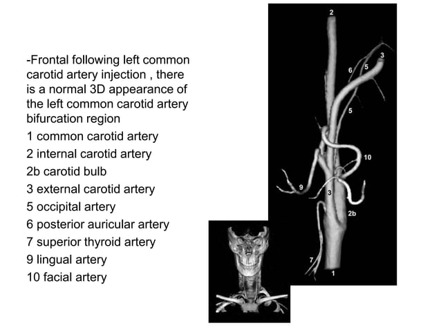 Anatomy of the external carotid artery (ECA) | PPT | Death, Injury, or ...
