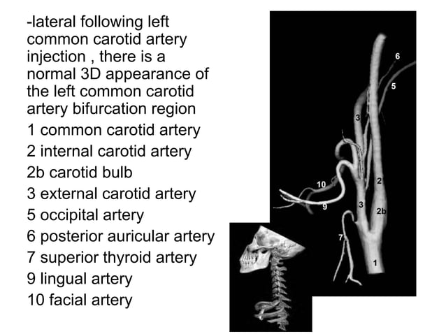 Anatomy of the external carotid artery (ECA) | PPT | Death, Injury, or ...