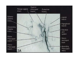 Anatomy of the external carotid artery (ECA) | PPT