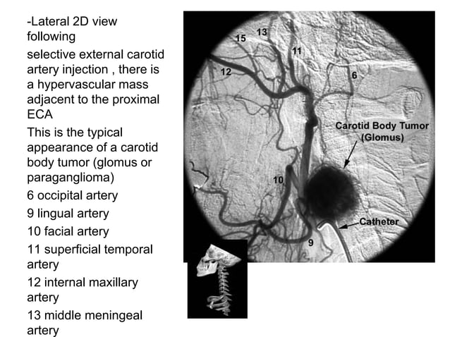 Anatomy of the external carotid artery (ECA) | PPT | Death, Injury, or ...