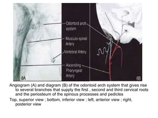 External Carotid Artery Branches Angiogram
