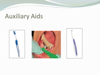 Implant Maintenance and Disease Prevention | PPTX