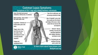 Ec case study lupus | PPTX | Blood Disorders | Diseases and Conditions