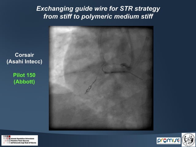 Novel antegrade wire dissection techniques | PPT