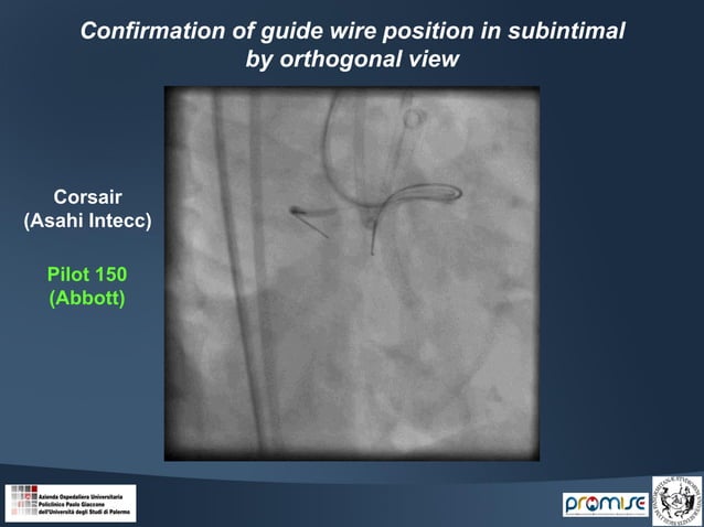 Novel antegrade wire dissection techniques | PPT