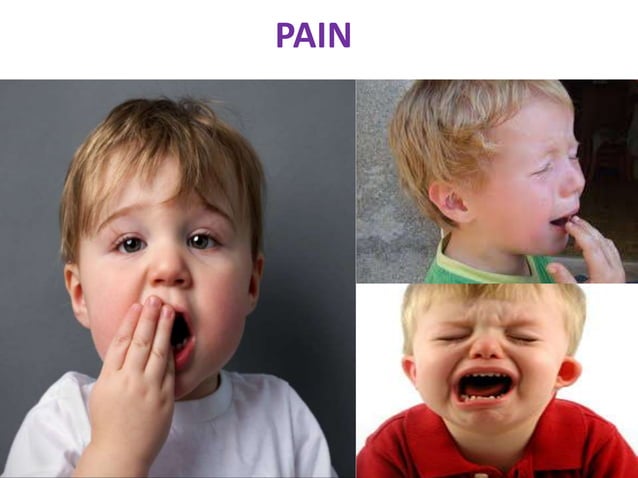 Ecc etiology & prevention | PPTX | Dental Health | Diseases and Conditions