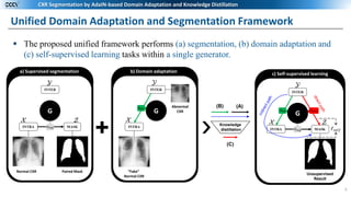 CXR Segmentation by AdaIN-based Domain Adaptation and Knowledge Distillation | PPT