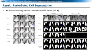 CXR Segmentation by AdaIN-based Domain Adaptation and Knowledge Distillation | PPT